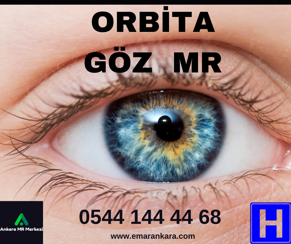 Orbita Göz MR (Emar) Nedir? Neden Çekilir? - Ankara Emar Merkezi Aynı ...
